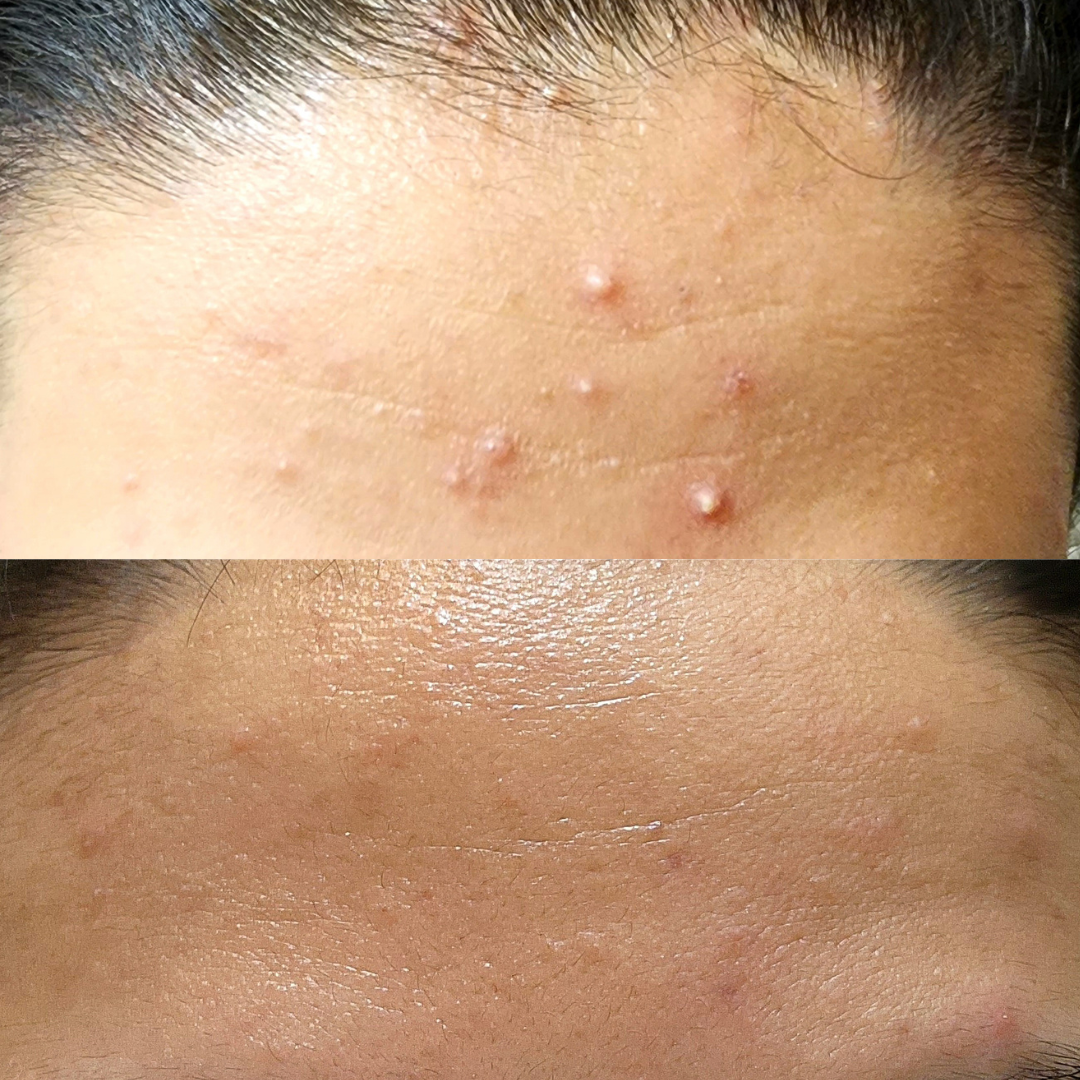 NaturaXotic- Natural, Tropical & Versatile Skincare Routine